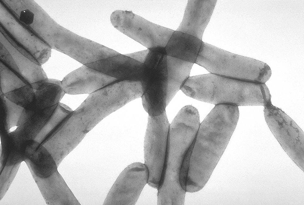 La legionela bajo control sanitario urgente